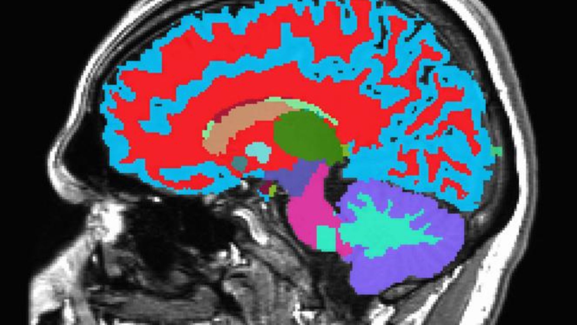 Harvard-Duke scientists decode brain’s aging clock using a single MRI scan