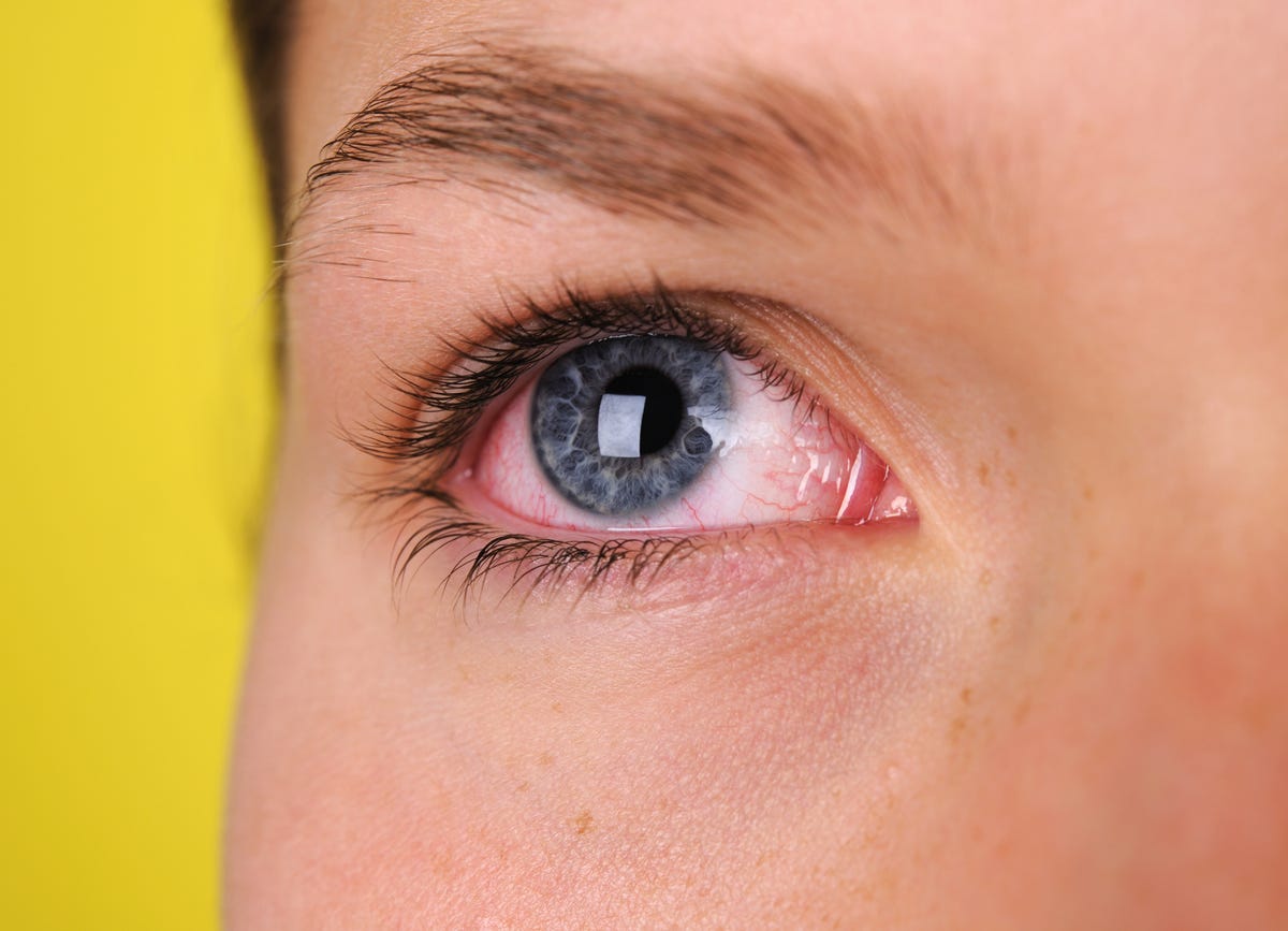 Doctors Say These Everyday Symptoms Could Be Signs of a Serious Disease
