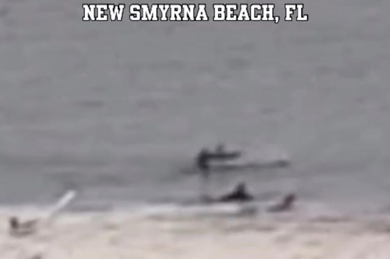 Man felt like he was 'hit by a car' after being head-butted by shark ...