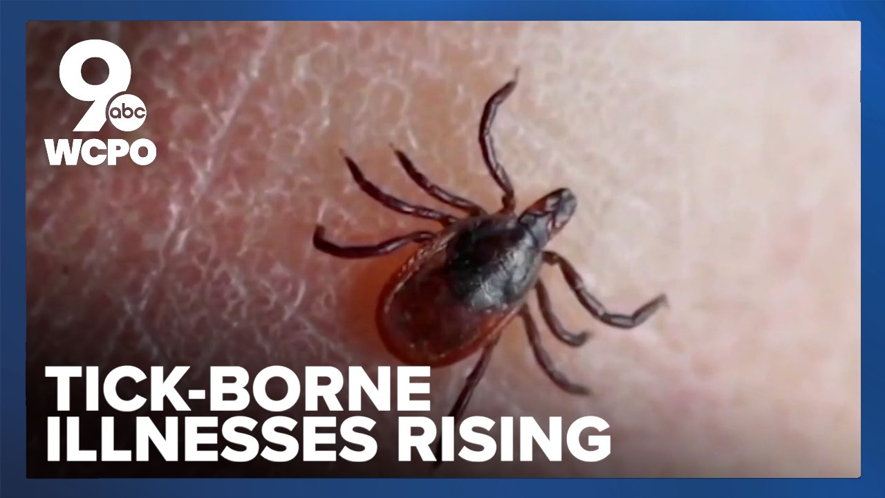 How to protect yourself from ticks this Fourth of July weekend