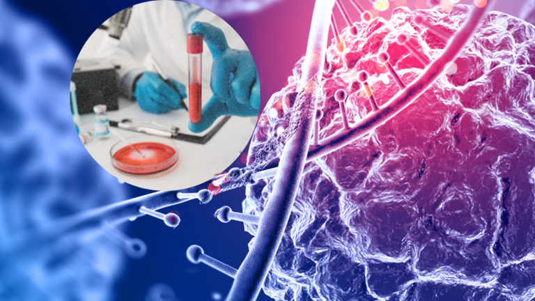 Scientists Detect Early Signs of Cancer In Patient Blood Years Before ...