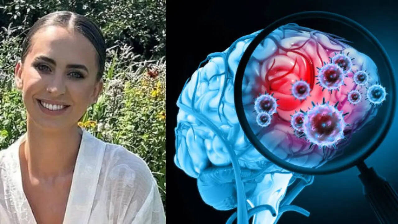 Doctors Miss Woman's Brain Tumour Five Times, Blaming Symptoms On a ...