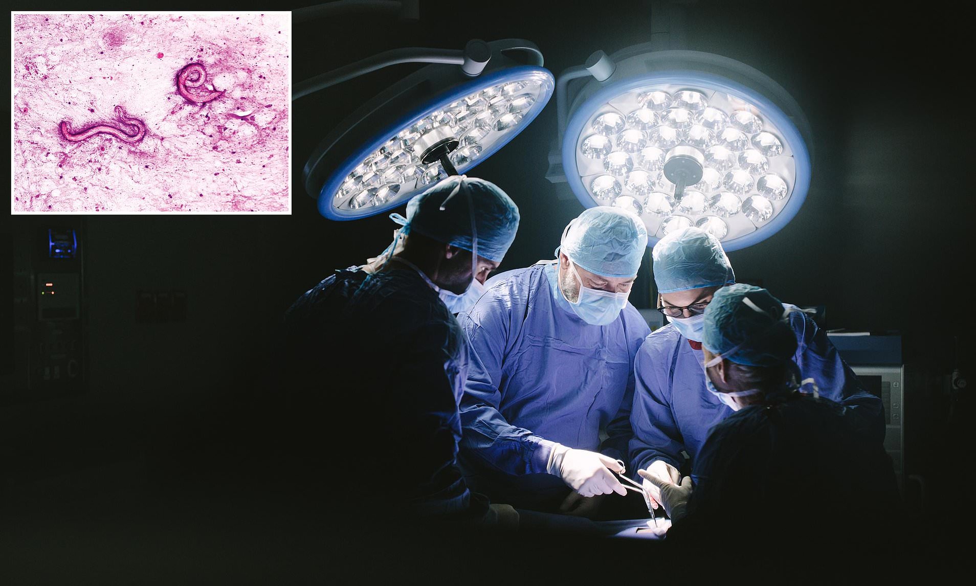 Men become infested with parasites after receiving infected organs ...