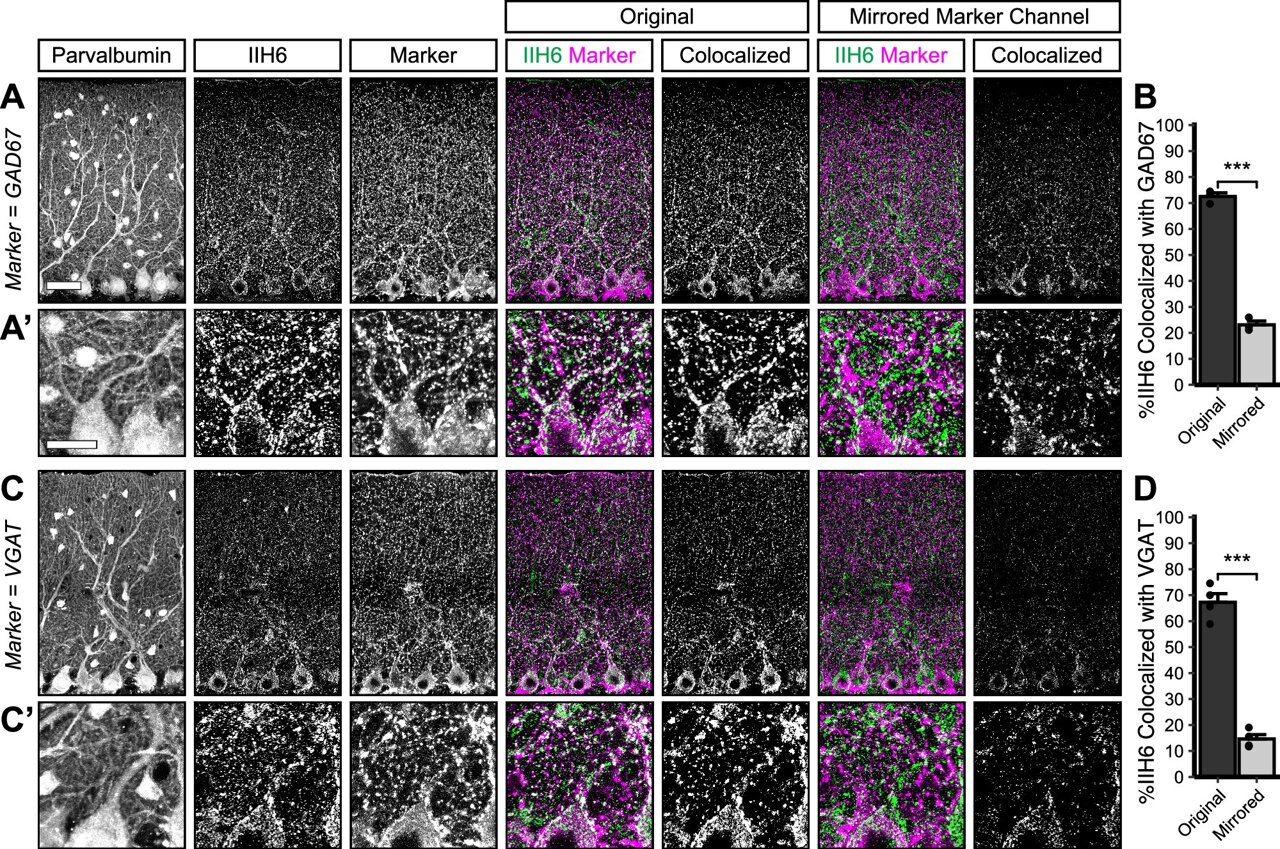 Researchers discover link between key protein and brain synapse development
