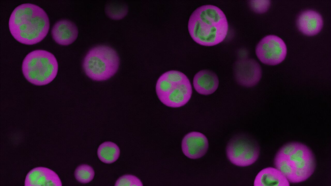 Artificial nucleolus model reveals step-by-step process of ribosome ...