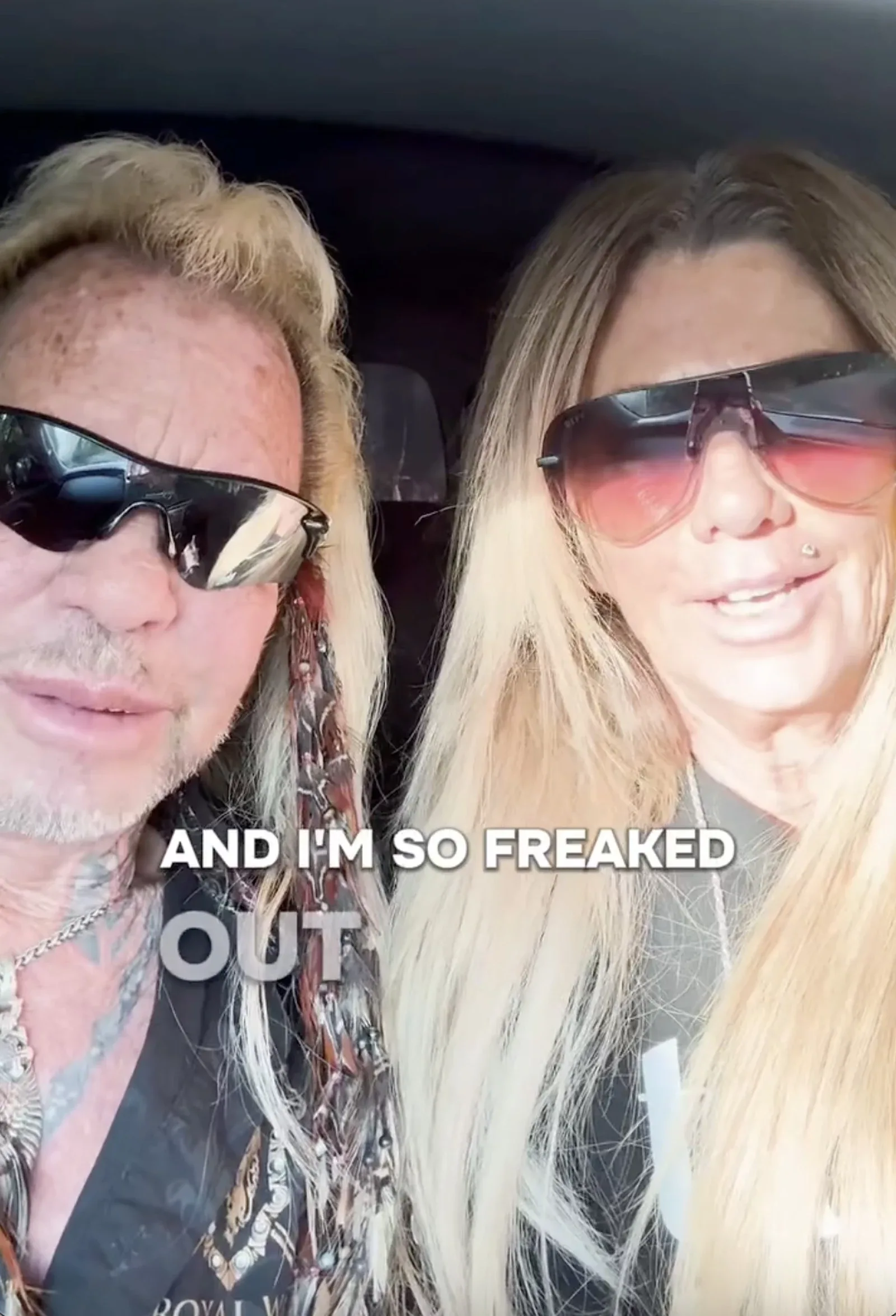 ‘Dog the Bounty Hunter’ Wife Francie Undergoes Major Oral Surgery [Picture]
