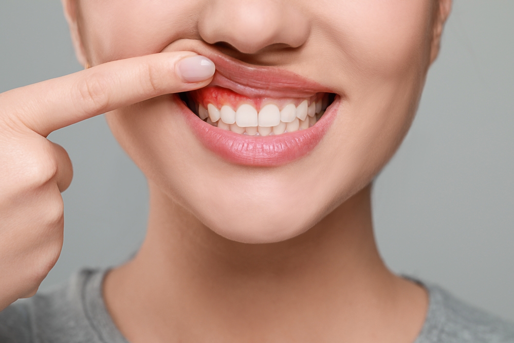 This everyday food could be ruining your gums, new research warns
