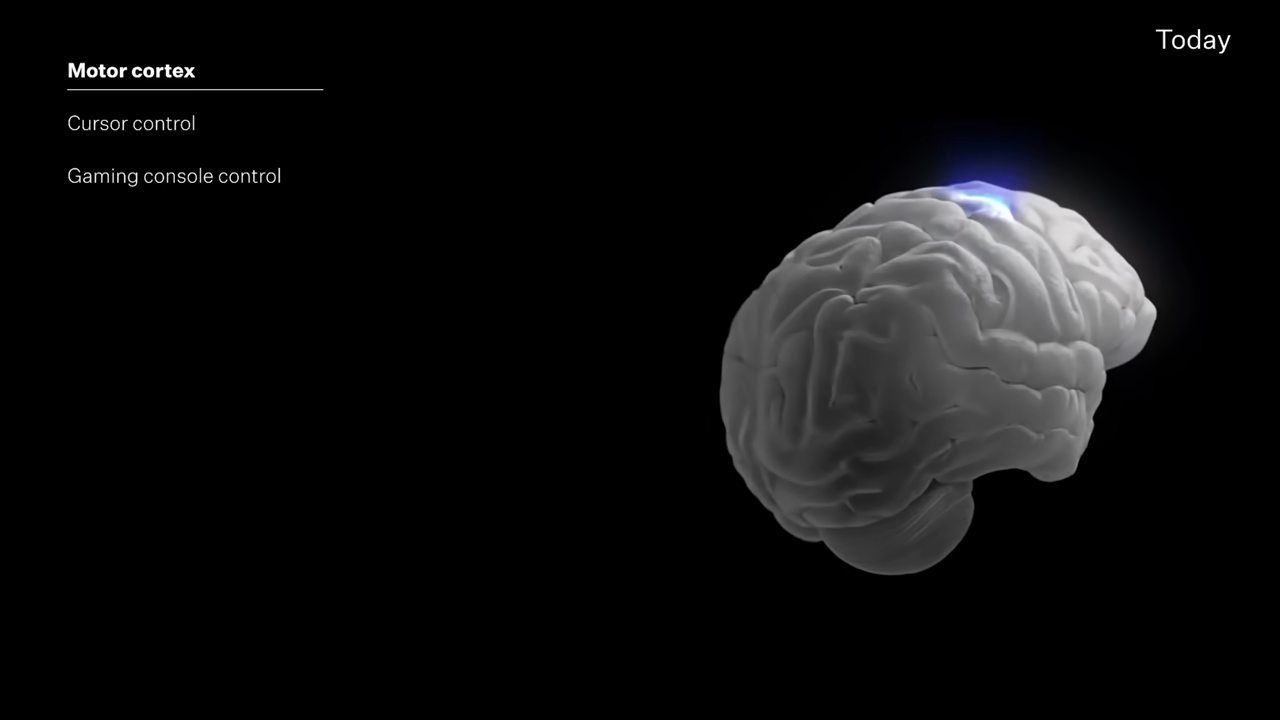 2026 Human Trials for Neuralink Blindsight Brain Implant Confirmed