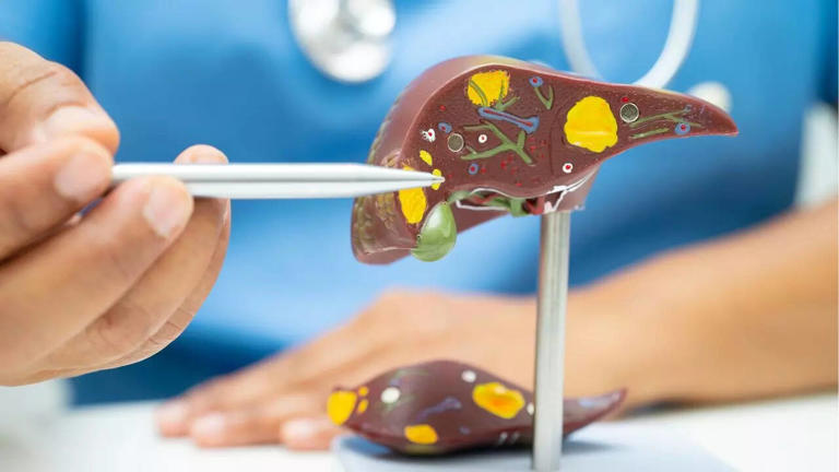 Understanding gallbladder cancer: Know its stages, causes, symptoms ...