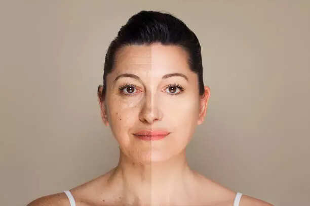 Say goodbye to fine lines: Kitchen remedies to reduce wrinkles naturally