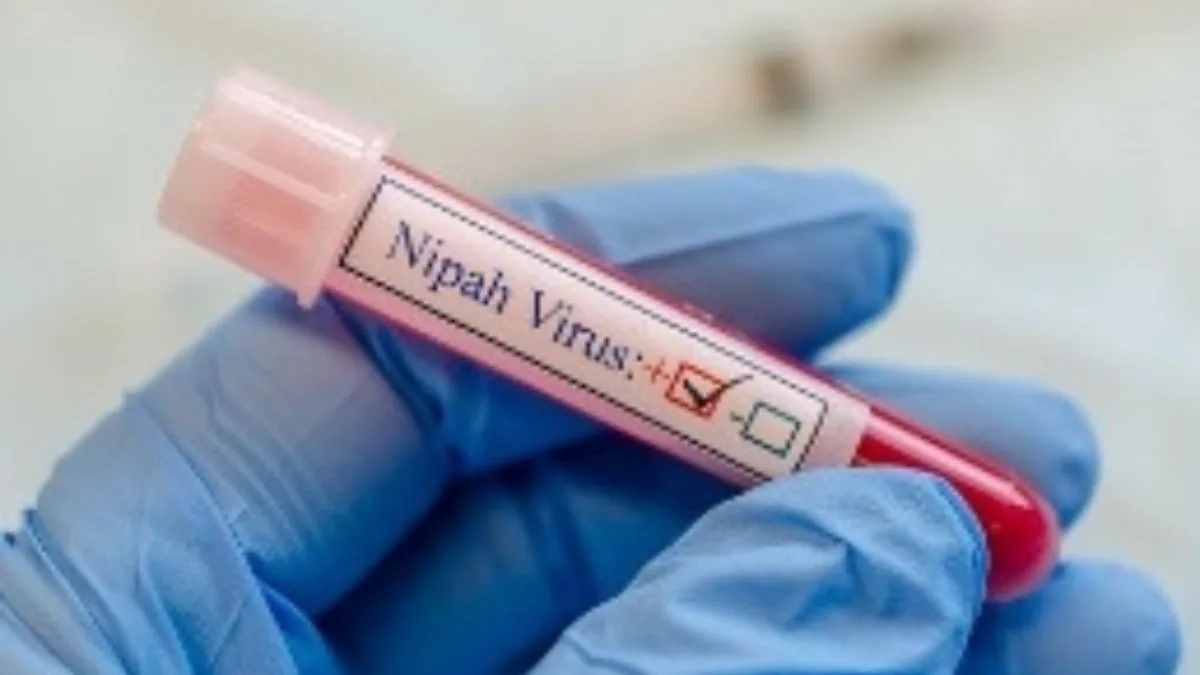 Slight improvement in condition of one Nipah-infected nurse