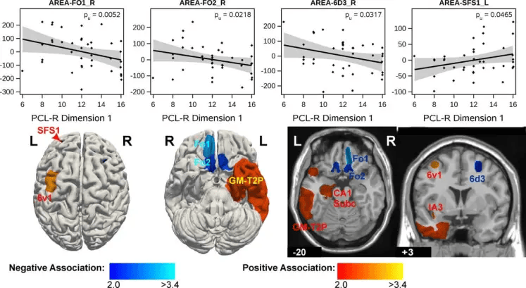 Unlocking the Psychopathic Mind: Neuroimaging Reveals Key Brain Differences