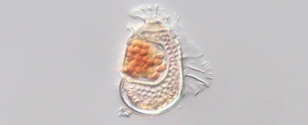 The Strangest Microbe Ever Found Straddles The Line Between Life and ...