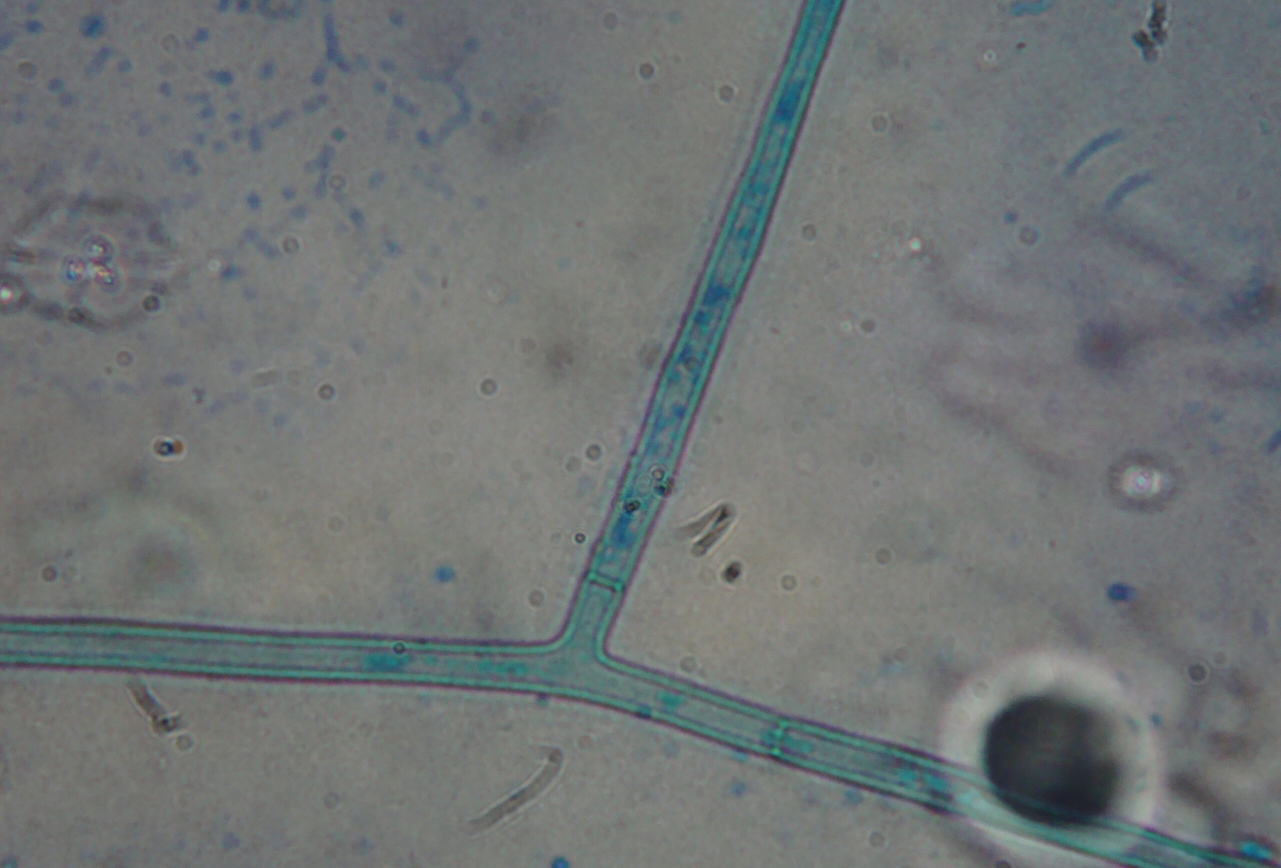 Síntomas y tratamiento de Rhizoctonia en plantas: guía completa para su ...