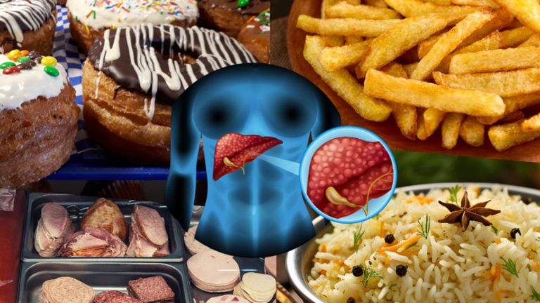 4 Foods That People With Fatty Liver Must Avoid Eating