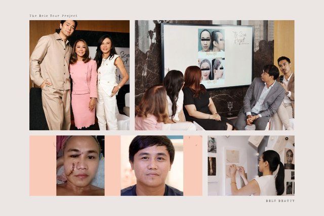 Belo Medical Group Launches The Scar Project, Calls for Seven Brave Stories