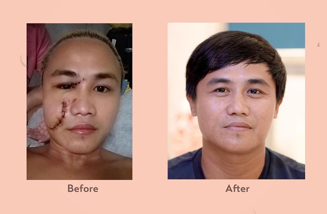 Belo Medical Group Launches The Scar Project, Calls for Seven Brave Stories