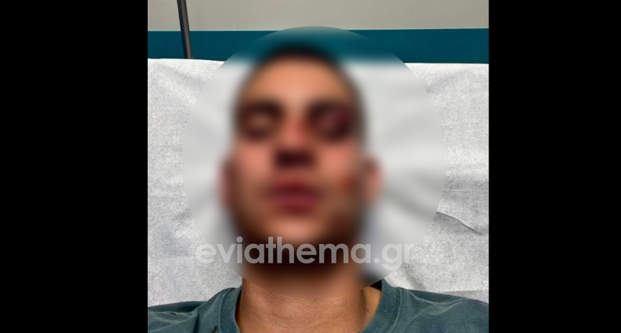 Χαλκίδα: Άγριος ξυλοδαρμός 19χρονου για ένα like στο Facebook – Στο ...