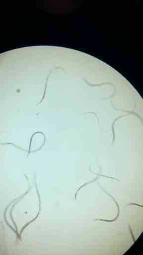 Microscope Magic: Discover the Hidden Details of Life
