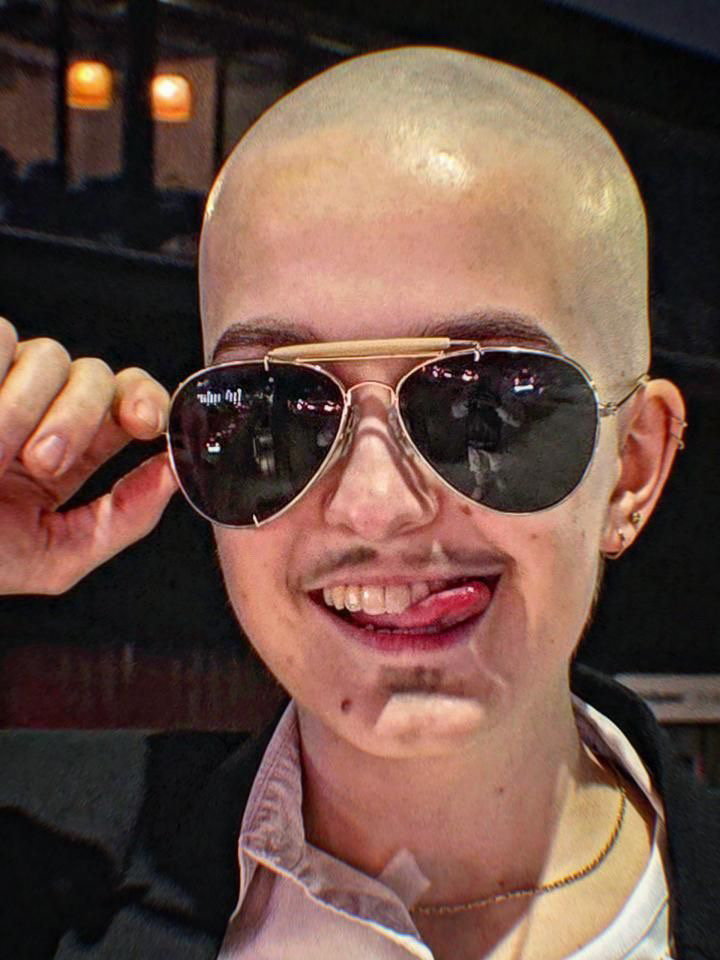 Woman shaves head to dress as Pitbull for concert – no bald cap needed