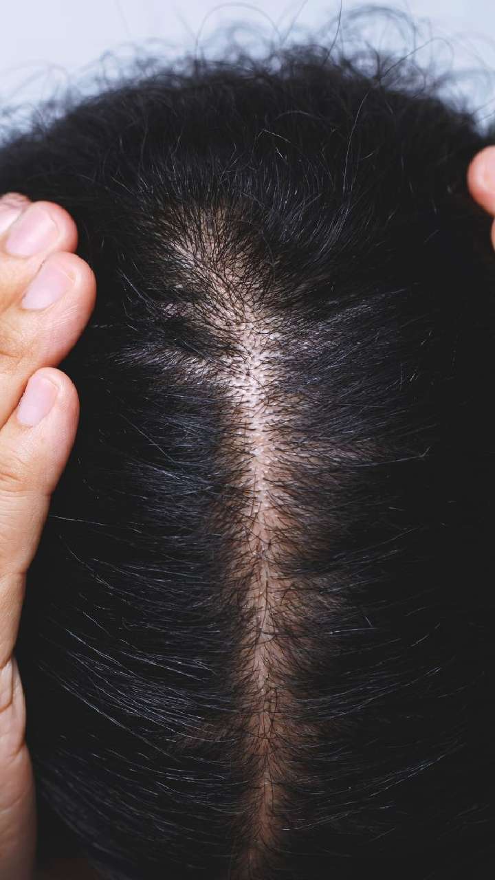 Hair Oil Vs Hair Mask: Which Is Better For Hair Growth?