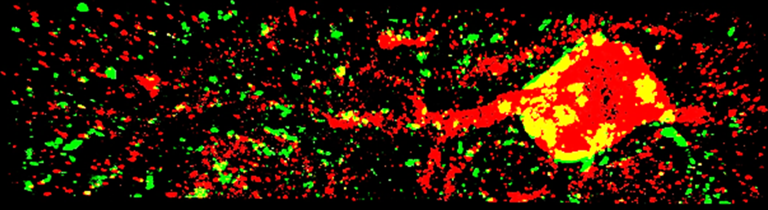 Neuropathic pain has no immediate cause – research on a brain receptor ...