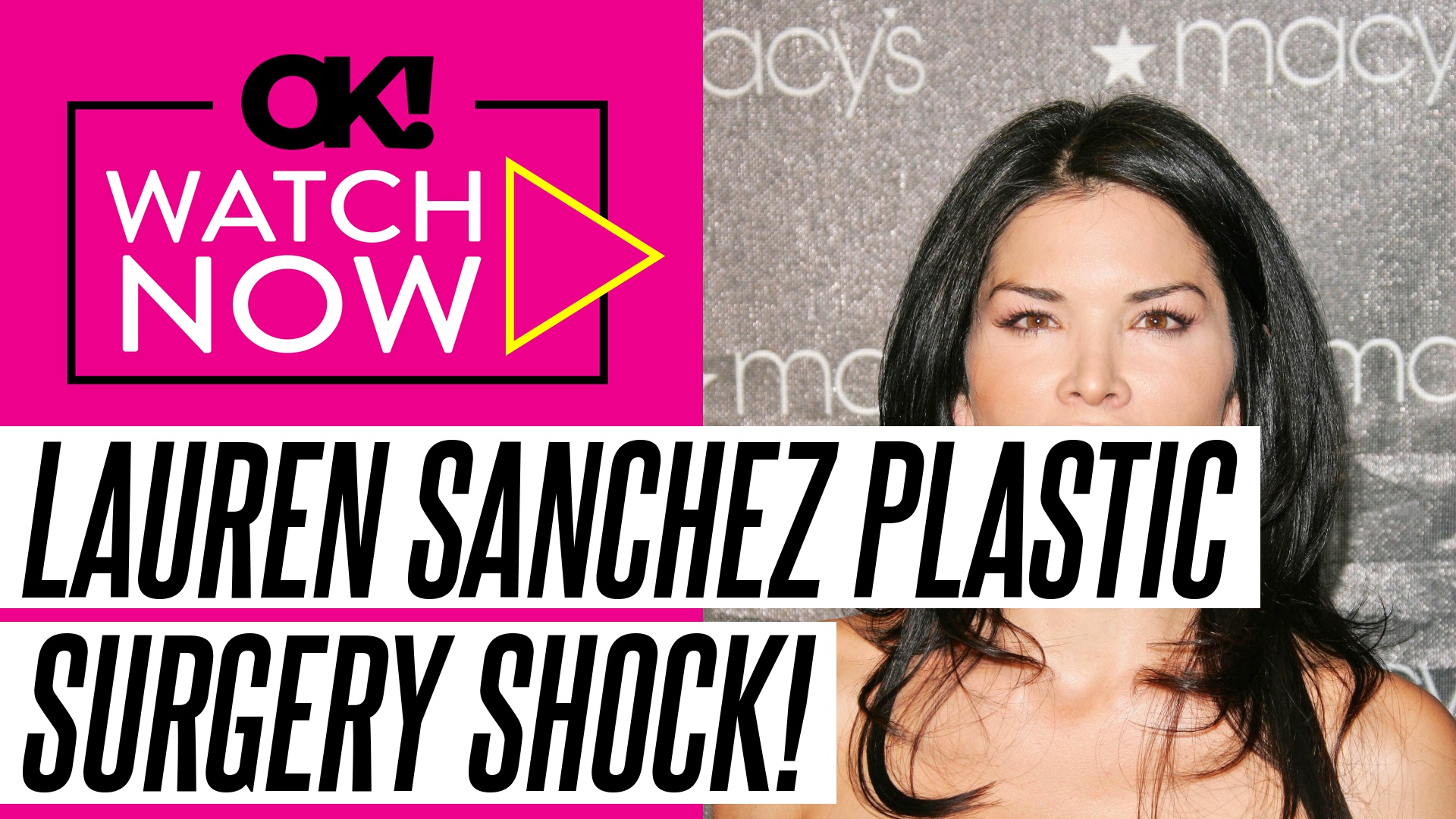 Did Lauren Sanchez Get Plastic Surgery? See Before and After Photos of ...