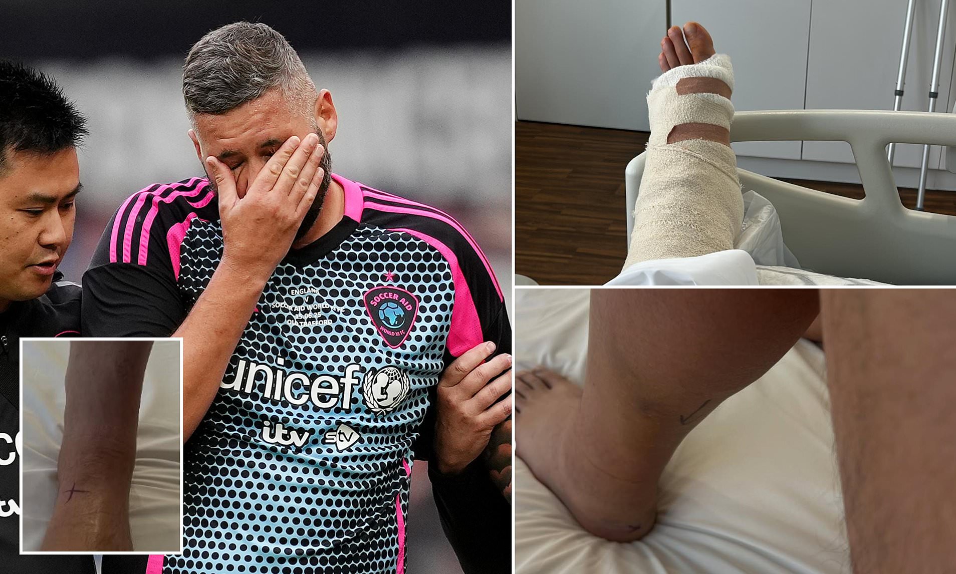 Tony Bellew admits 'pain is real' after surgery on gruesome Achilles ...