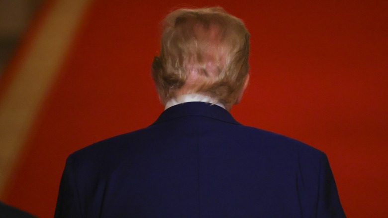 Trump's Hair Can't Hide Bald Spots Anymore & His Bright Scalp Is ...