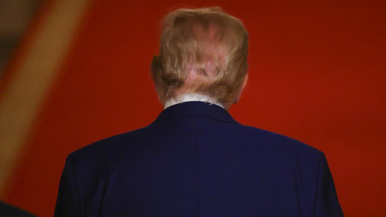 Trump's Hair Can't Hide Bald Spots Anymore & His Bright Scalp Is ...