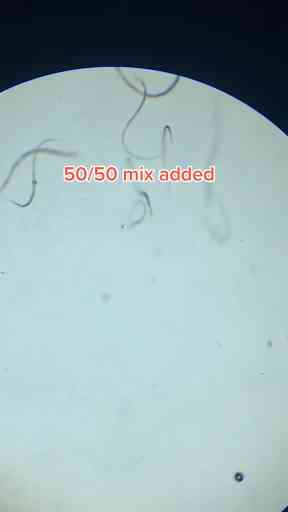 What This Looks Like Under a Microscope Will Shock You