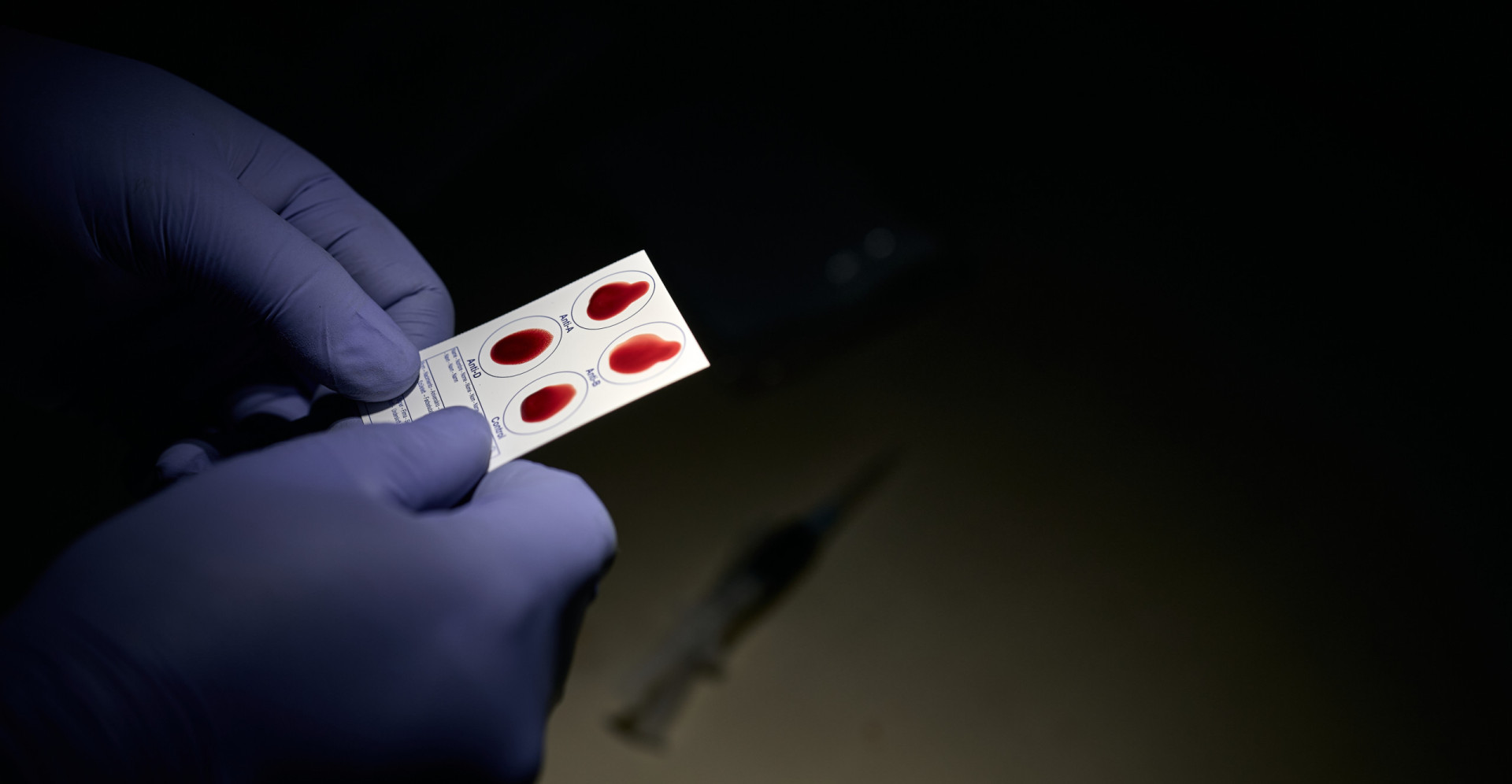 Scientists discover incredibly rare blood type