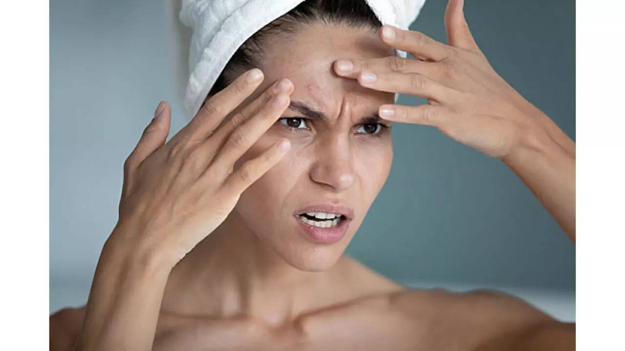 Stress taking a toll on your skin? Causes, conditions, and treatment advice