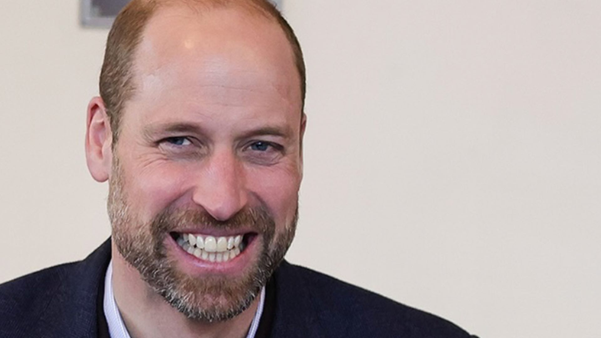 Prince Williams reveals a never-before-seen anecdote about his scar