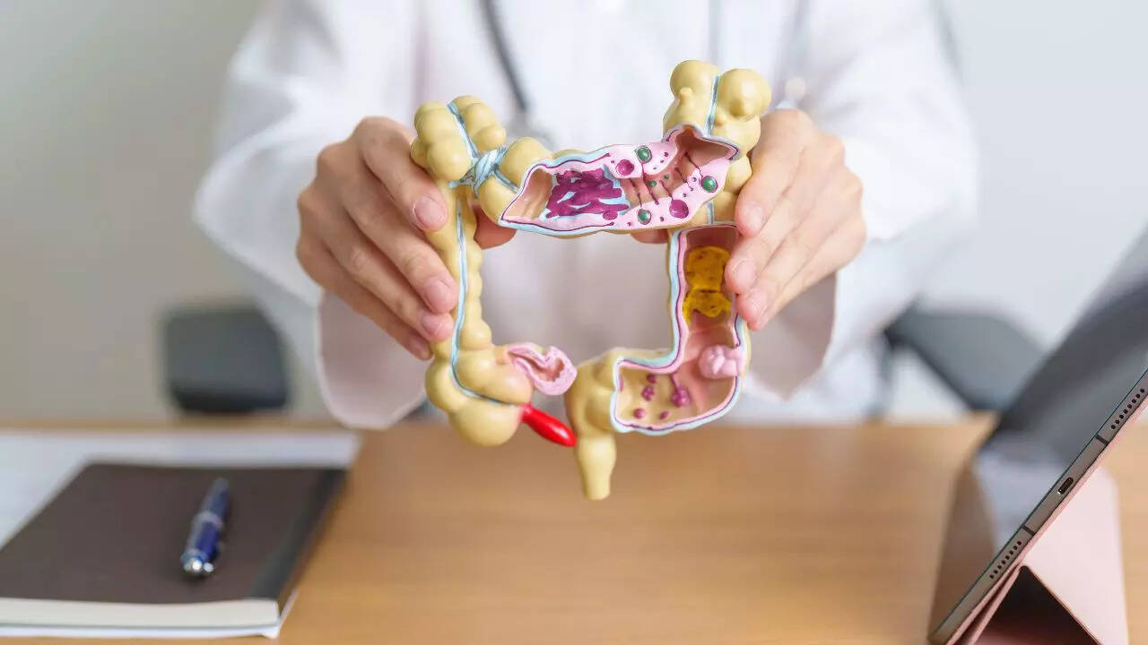 Bowel cancer: 5 early signs and symptoms that often go unnoticed
