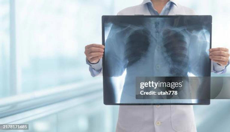 Daiichi Sankyo, AstraZeneca gets U.S. approval for Datroway