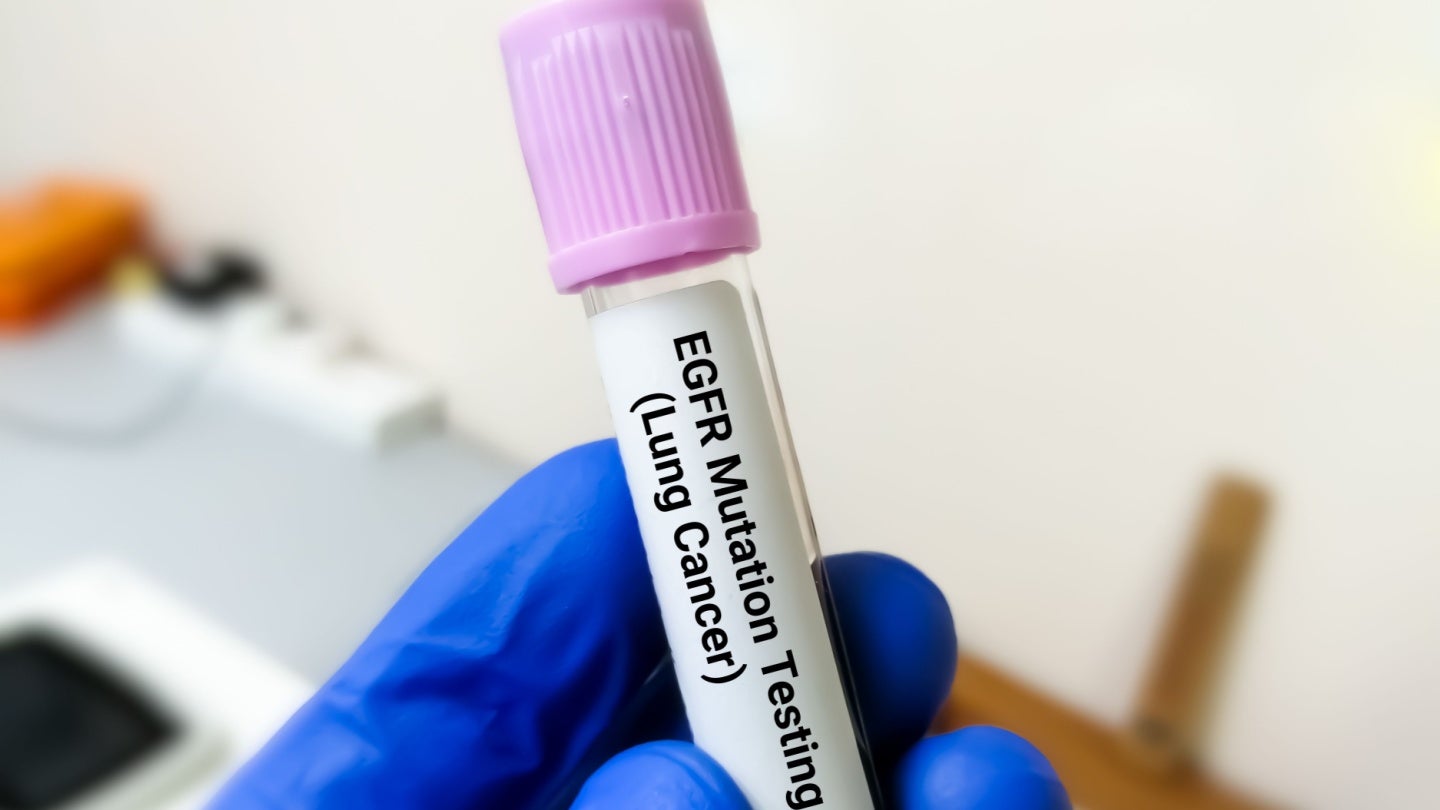 FDA approves AstraZeneca and Daiichi Sankyo’s Datroway for NSCLC