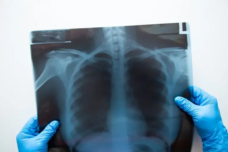 Parkway Radiology completes integration of AI chest x-ray tool