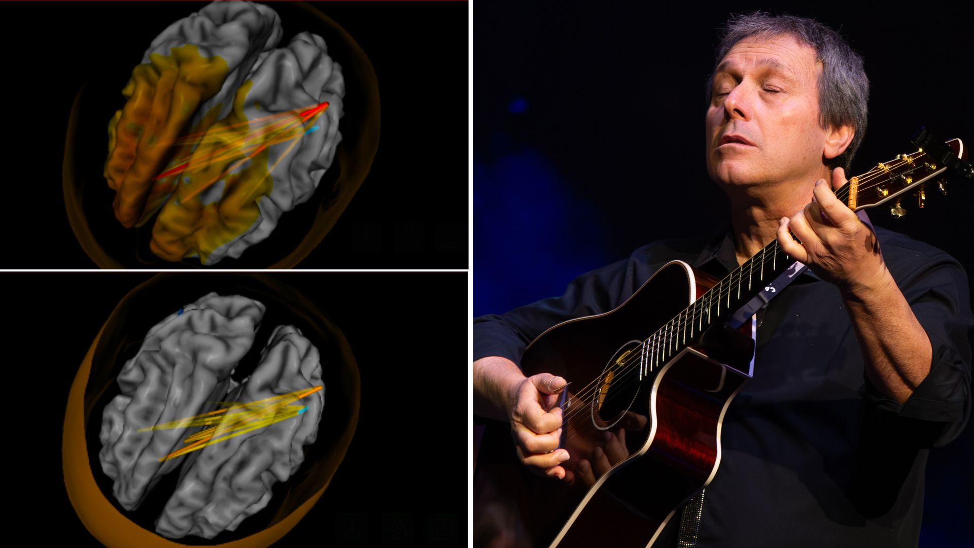 Acoustic guitar virtuoso Peppino D’Agostino hopes to help pain ...