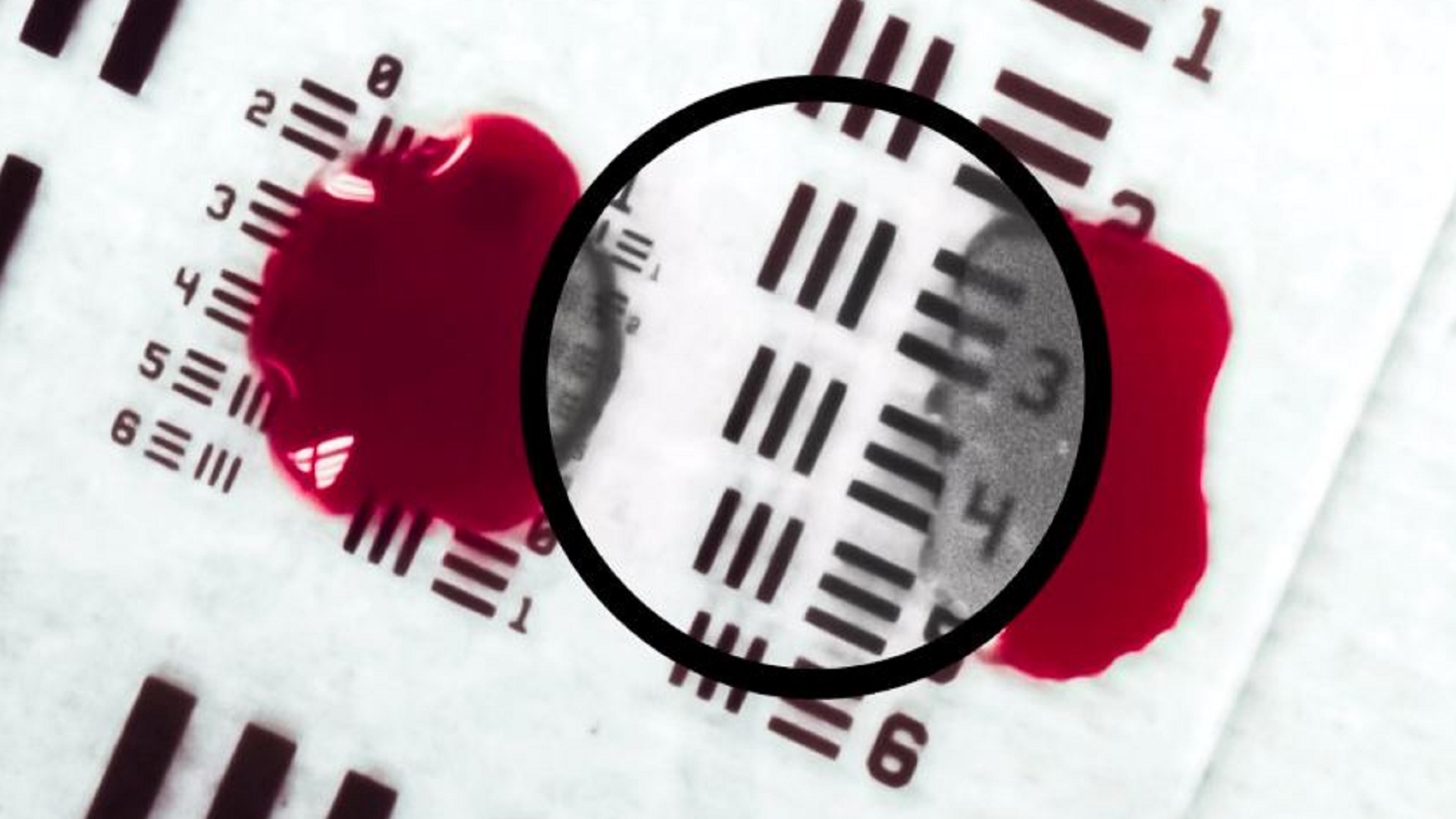 US startup unveils surgical tech that renders blood ‘translucent ...