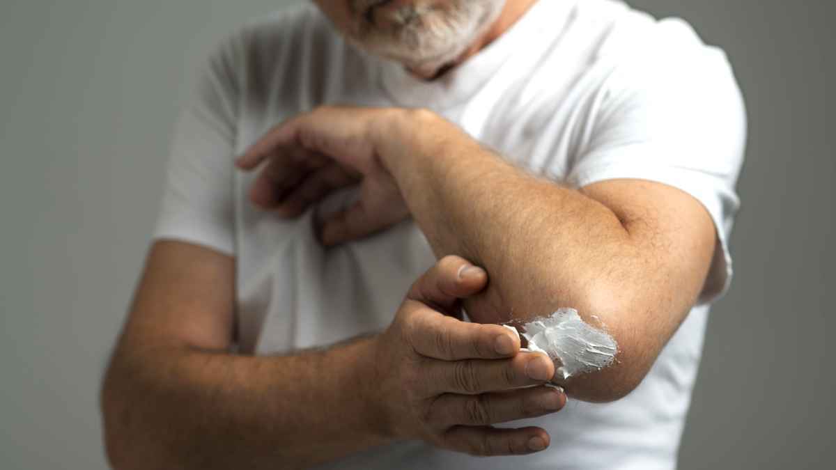 Is it true that butter soothes minor burns?