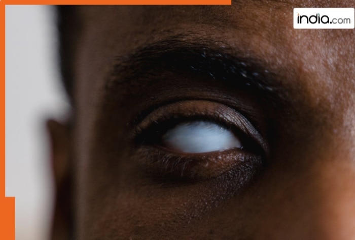 7 cataract myths you should stop believing immediately