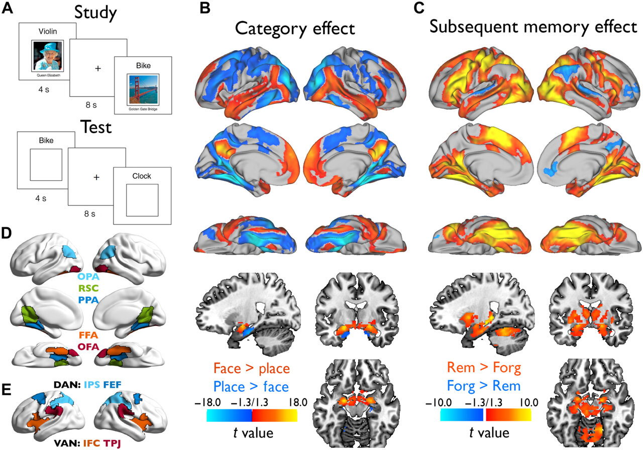 Study reveals how Alzheimer's disease and attention shape our ability ...