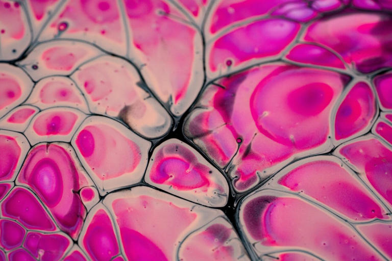 Common medicine for autoimmune diseases works on giant cell arteritis