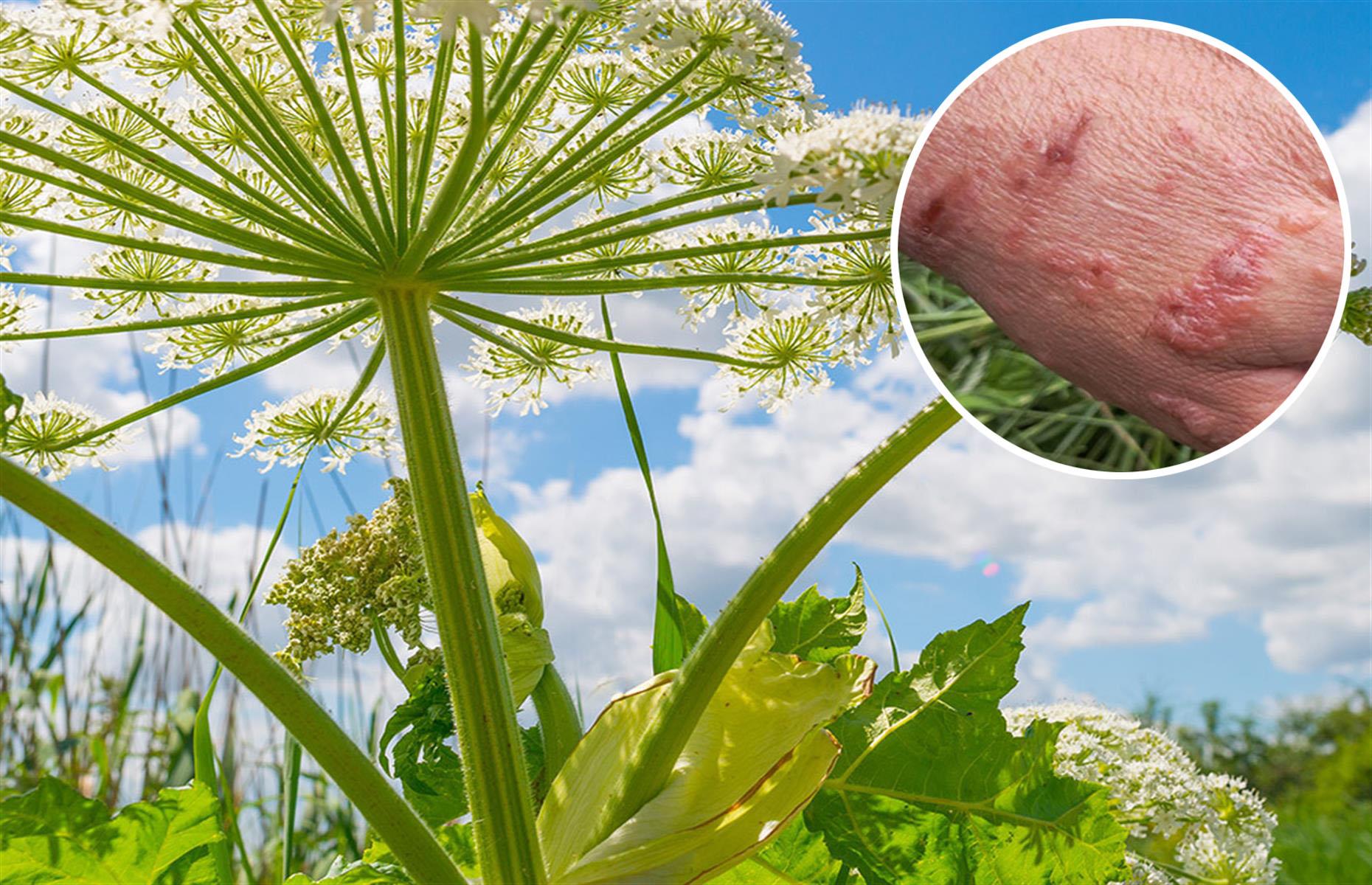 Your Garden Could Be Under Attack From These 9 Invasive Plants