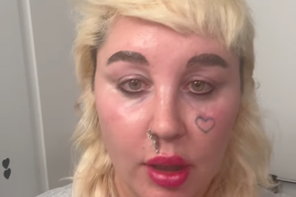 Amanda Bynes reveals she is taking Ozempic to ‘look better in paparazzi ...