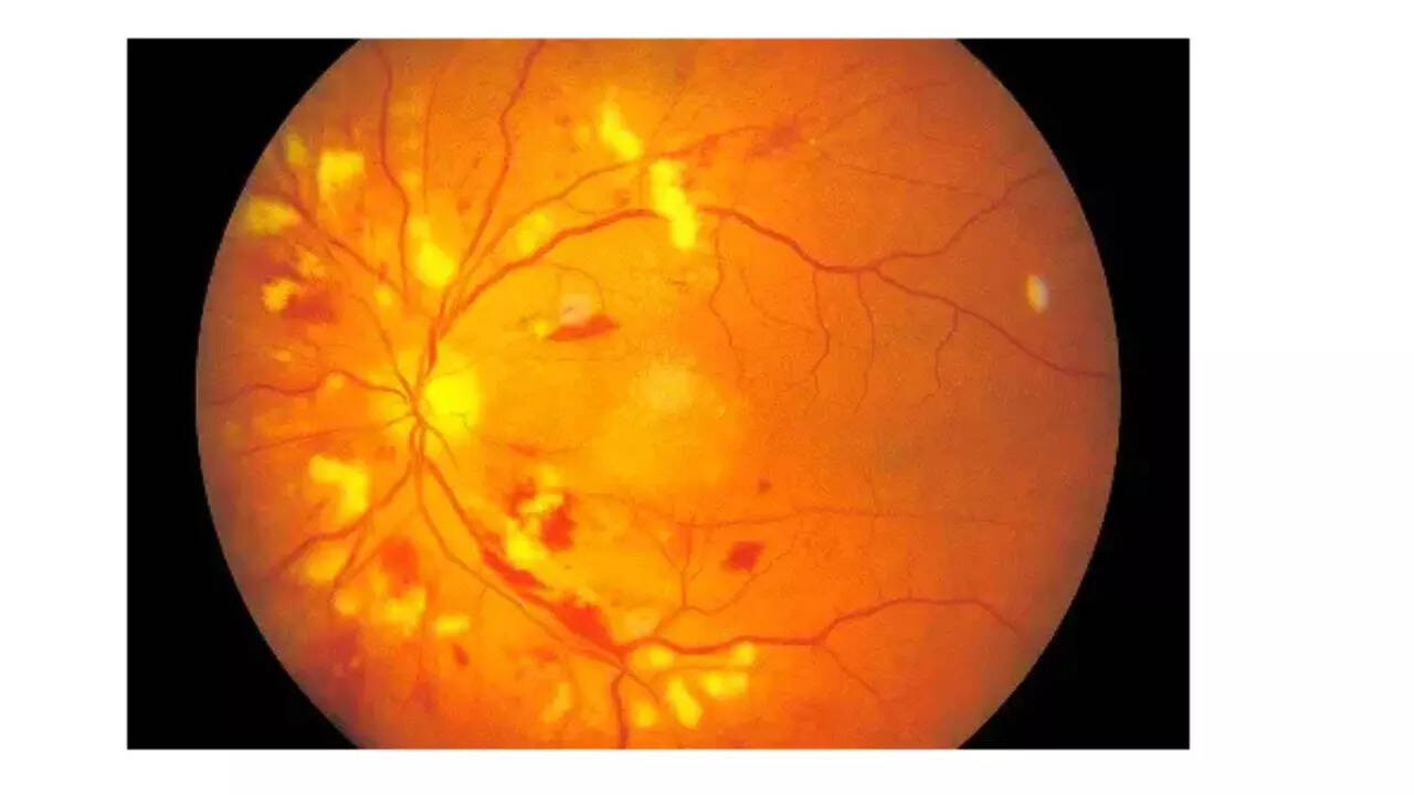 5 diseases that your eyes can reveal (and how to check for them)