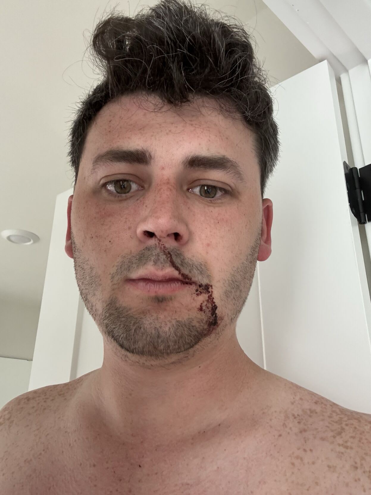 Seattle PD forwards felony assault charge to prosecutor 10 days after ...