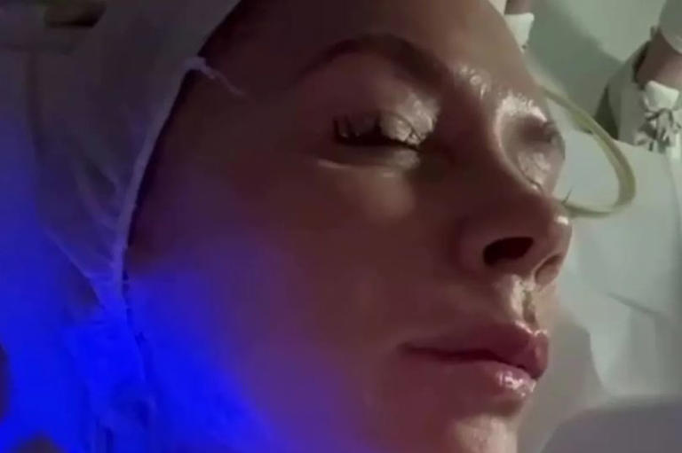 Victoria Beckham shares results of 'mini lift' face treatment she swears by