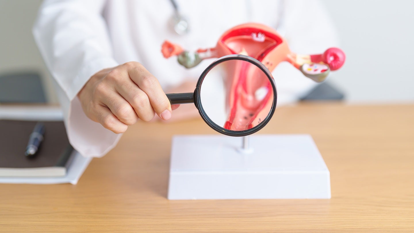 Bio-Thera Solutions doses first subject in Phase III ADC ovarian cancer ...